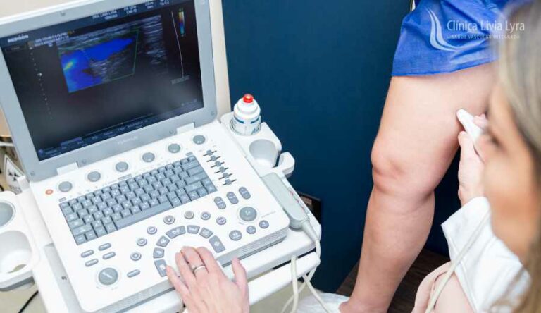 Duplex scan - Clínica Lívia Lyra - Saúde vascular